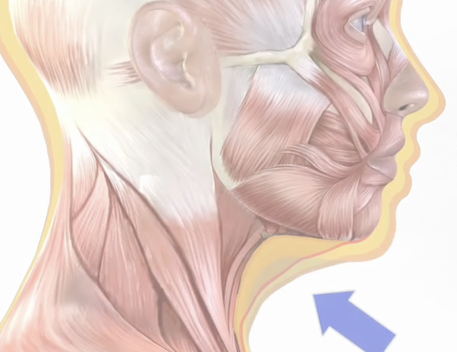 LIFTING DE PESCOÇO - Dr. Daniel Vasconcellos